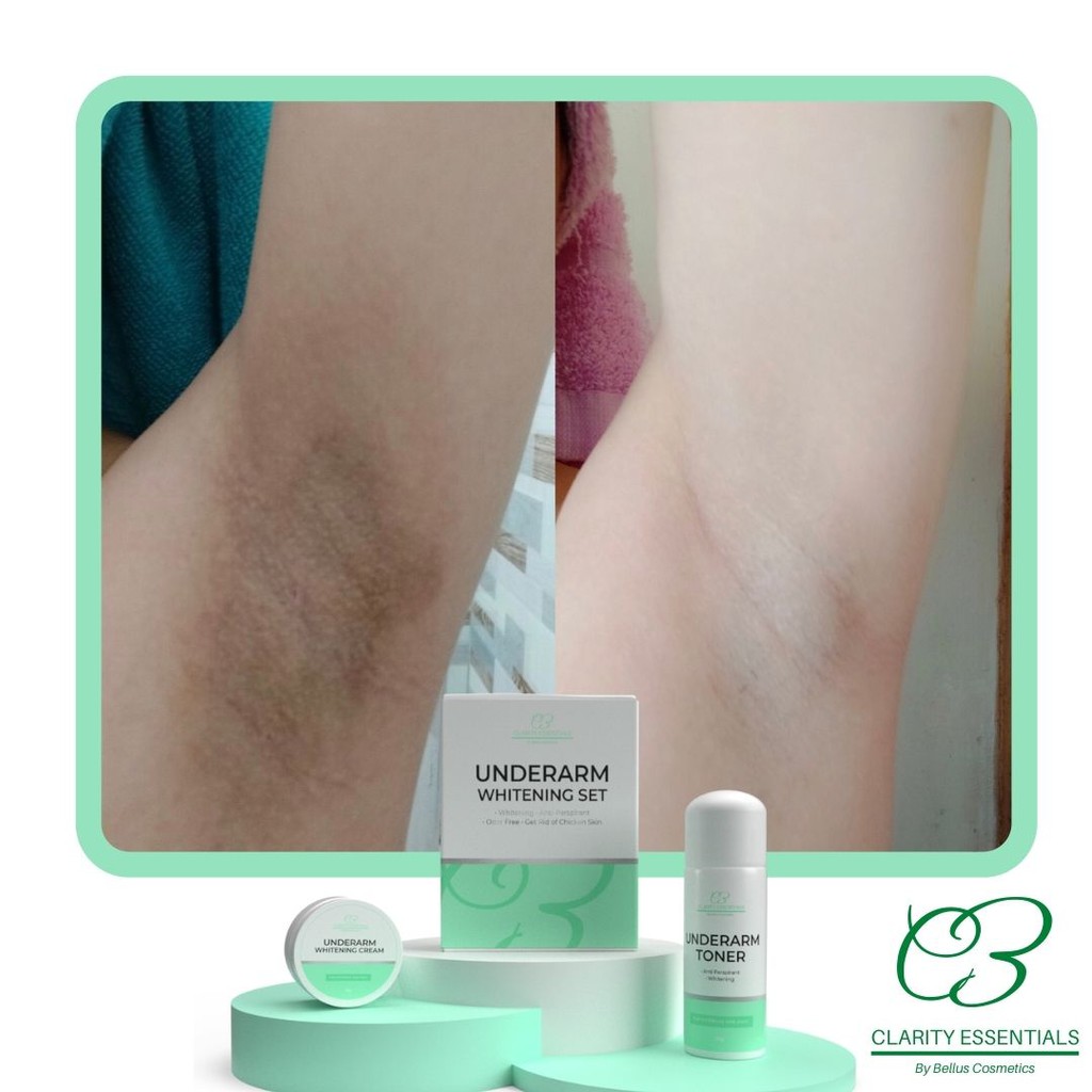 Underarm Whitening Set | Whitening Toner and Underarm Whitening Cream ...