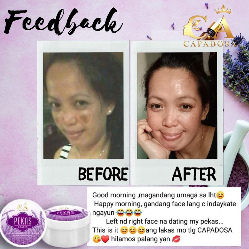 Capadosa Pekas Eraser Cream (Melasma/Peklat Eraser) | Shopee Philippines
