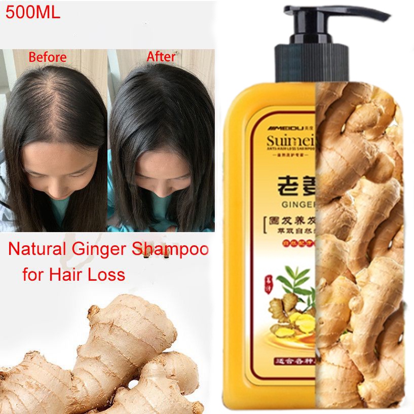 500ml Original ginger shampoo Anti Hair Loss ginger hair care shampoo ...