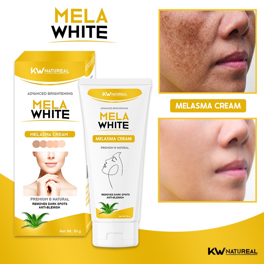 Original Melawhite Melasma Cream Pekas Freckle Melasma Remover