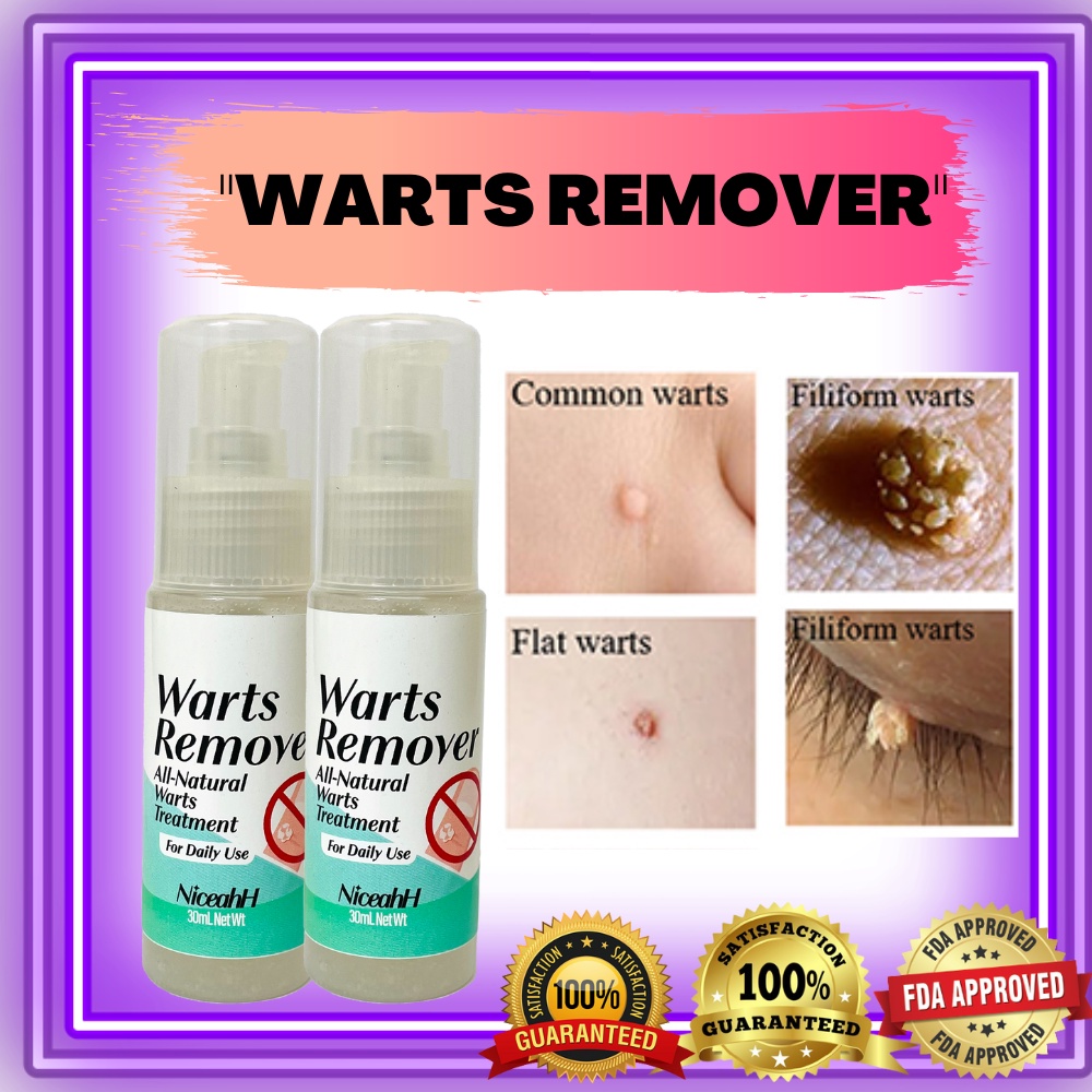New Effective Warts remover 30ml Removes all types of warts 100% ...