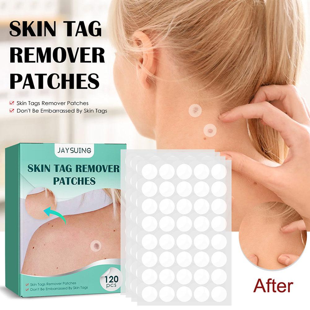 120Pcs Skin Tag Remover Patch Pimple Wart Treat Quick Absorb Plaster ...