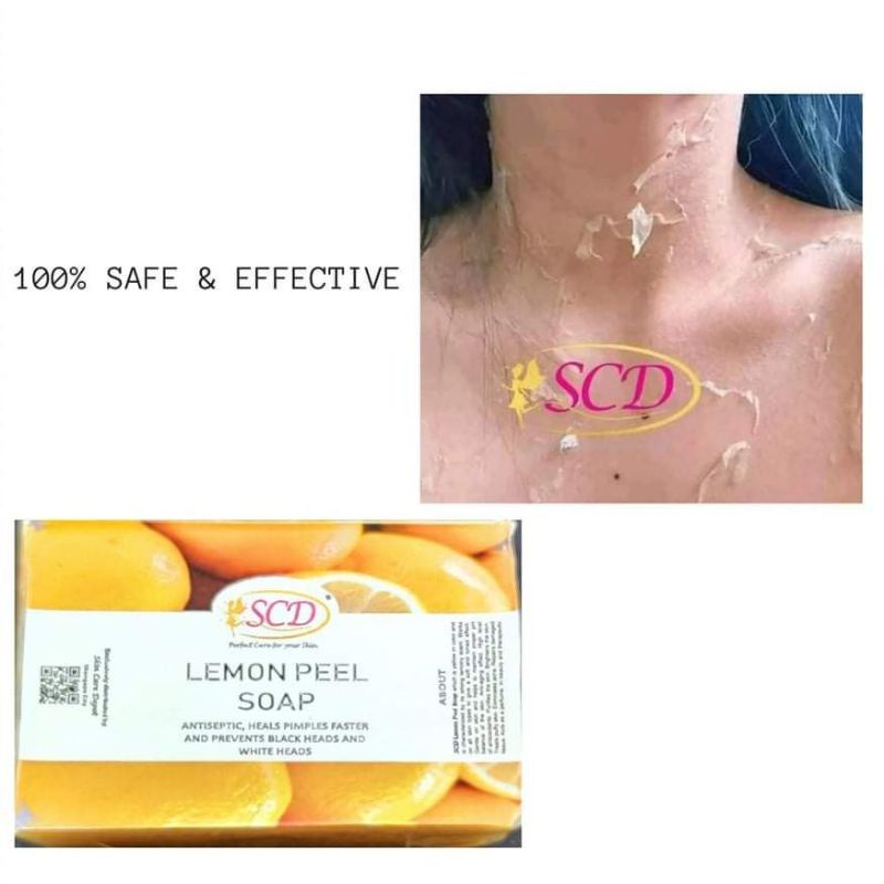 BEST SELLER TRENDING LEMON SOAP SCD SOAP SCD PRODUCTS/BEAUTY SOAP/BAR ...