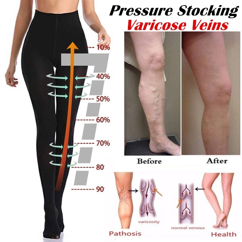 Breathable Compression Pressure Stocking Prevent Varicose Veins ...