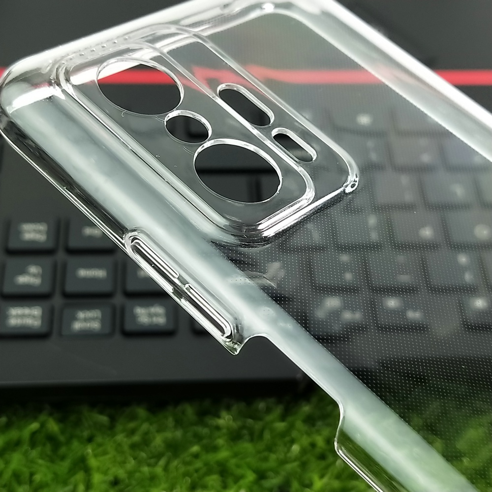 For Xiaomi 11T Pro Civi Case Crystal Hard PC Full Cover Clear Camera ...