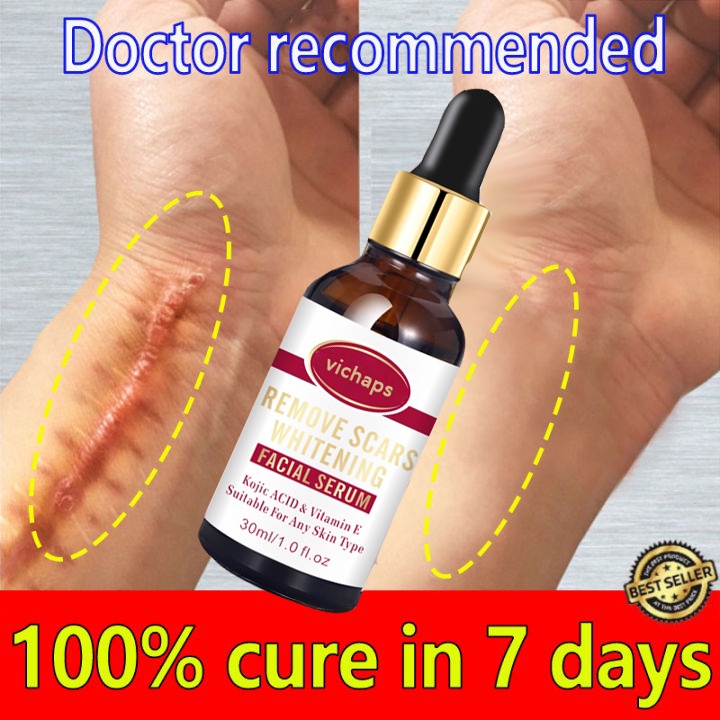 Scar Removal Serum Scar Remover for Legs Acne Treatment Anti Acne Skin ...