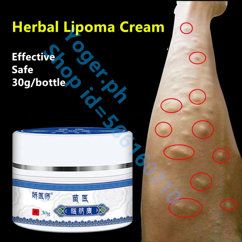 30g/box Herbal Lipoma Health Cream Remove Lipoma Lipomatosis Fibroma ...