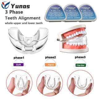 retainers - Best Prices and Online Promos - Dec 2022 | Shopee Philippines