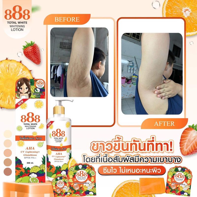 *888 Total white whitening Lotion from Thailand 250mL*** | Shopee ...