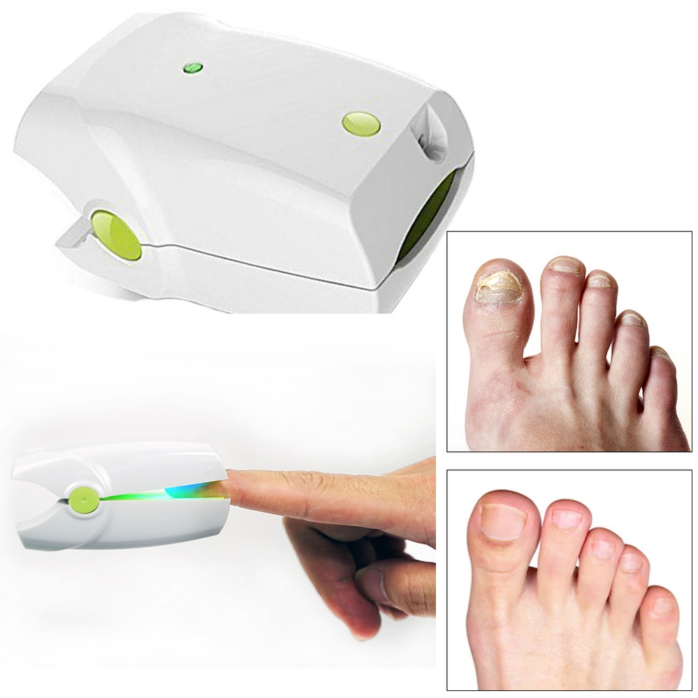 Portable nail laser fungus cold laser nail fungal Infection grey color ...