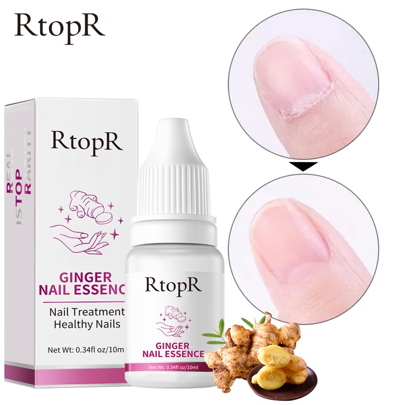 RtopR Ginger Antibacterial Nail Treatment Onychomycosis Paronychia Anti ...