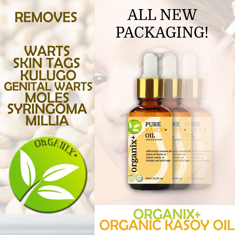 ORGANIX Pure Authentic Organic Kasoy Oil Warts, Skin Tags, Skin Growth ...