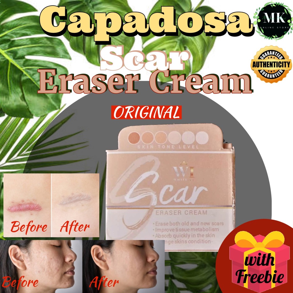 MK White In Scar Eraser Cream/10g/Original/COD | Shopee Philippines