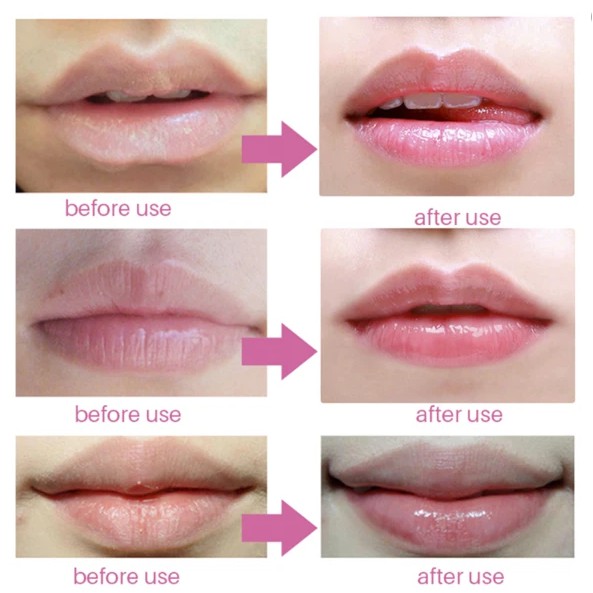 Ways Of Having Pink Lips Naturally | Lipstutorial.org