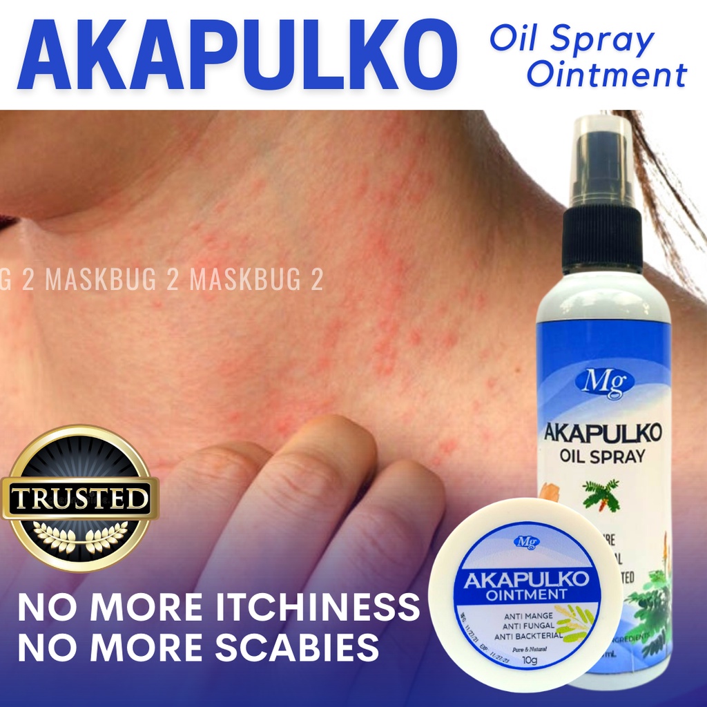[MASKBUG 2]BUNDLE SET Akapulko Oil Spray and Ointment | Treat Different ...