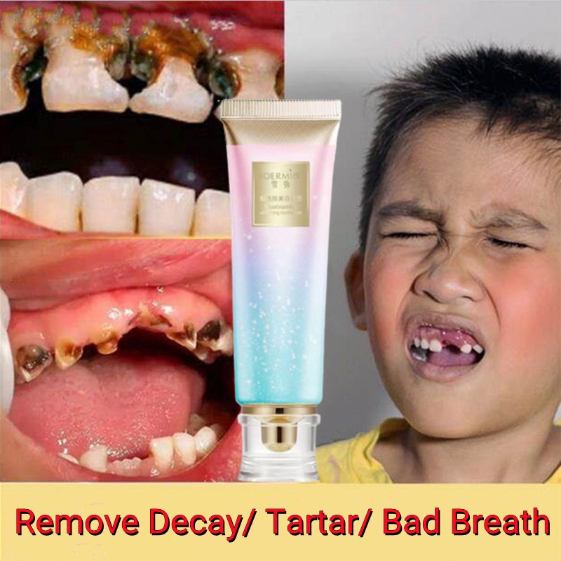 whitening toothpaste pampaputi ng ngipin teeth cleaner remove yellow ...