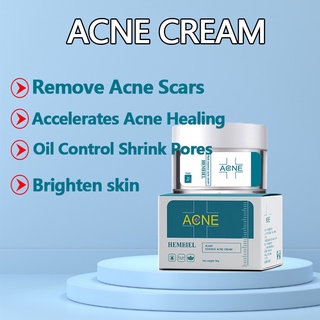 HEMEIEL Pimples & Acne Remover Best Seller/Mabisang Gamot Sa Tigyawat ...
