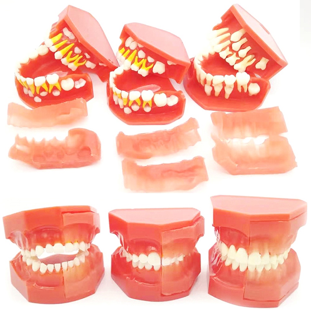 Dental Tooth Teeth Anatomical Anatomy Model Children Dental Model Baby ...