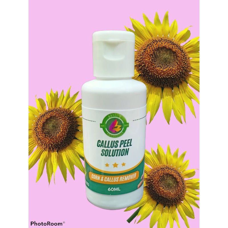 Kalyo Peel/Callus Peel Remover/Callus Peel Solution 60ml | Shopee Philippines
