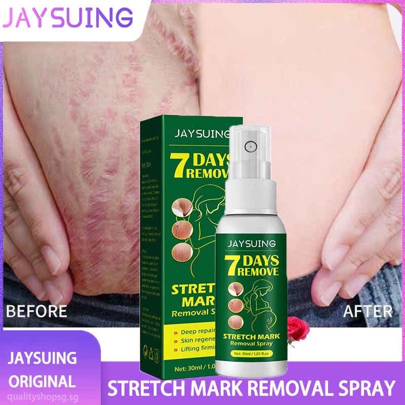 Stretch Mark Spray 30ML Repair Removal Acne Scar Stretch Marks Cream ...