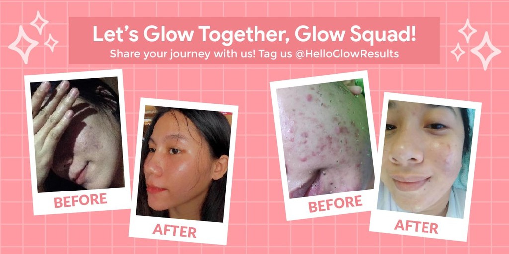 HELLO GLOW, Online Shop | Shopee Philippines