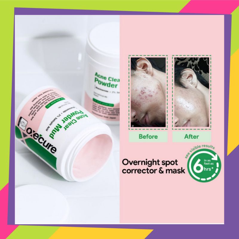 Oxecure Acne Clear Powder Mud 50g | Shopee Philippines