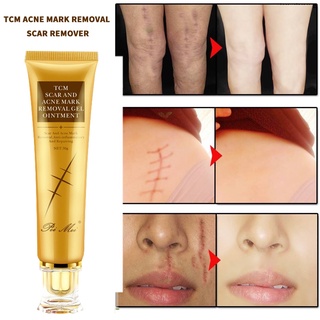 Scar Removal Cream peklat remover acne scar remover stretch mark ...