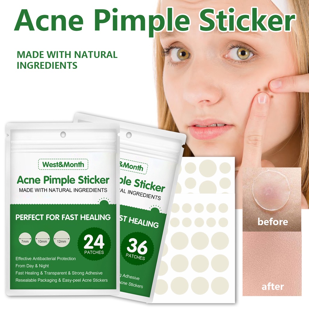 36patches/bag Invisible Acne Removal Pimple Patch Treatment Pimple acne ...