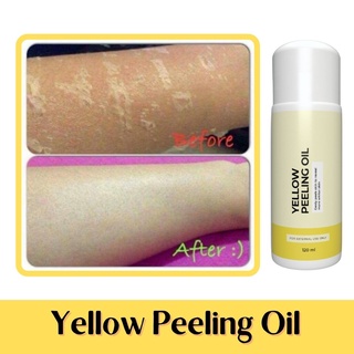 Yellow Peeling Oil | Skin Peeling | Body Peeling | Clarity Essentials ...