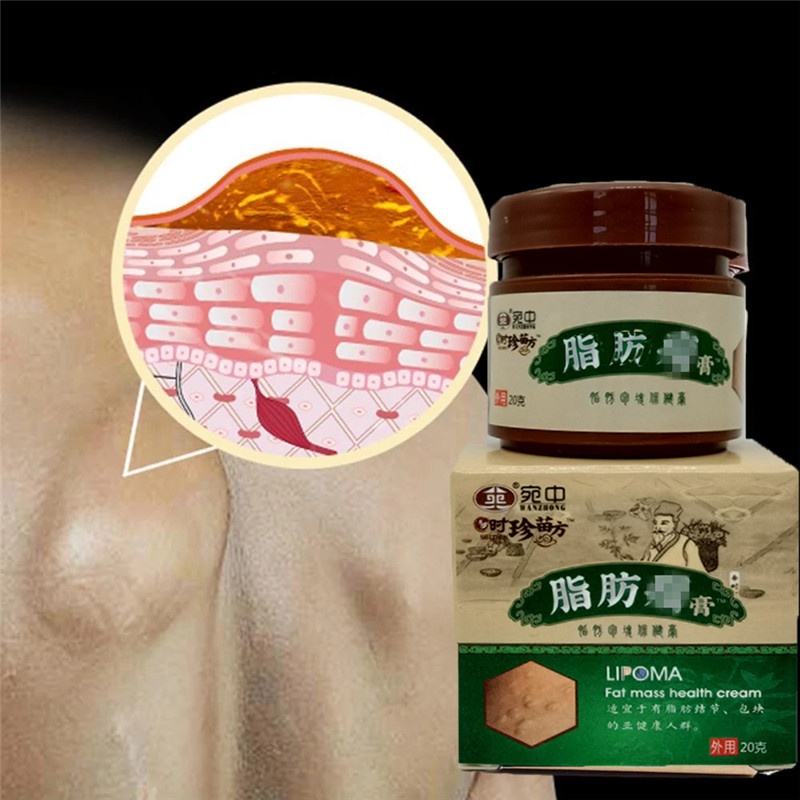 20g Lipoma Removal Cream Treat Tumor Skin Swelling Ointment Exfoliating ...