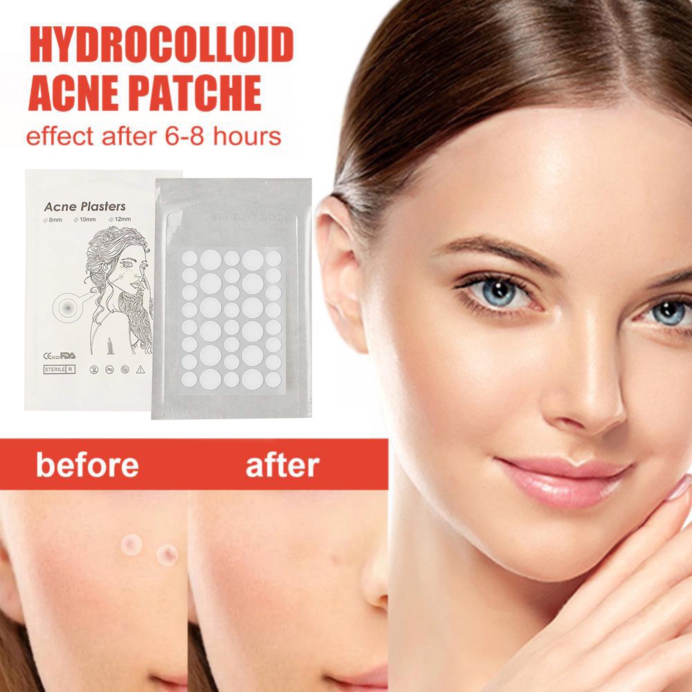 36PCS Acne Pimple Patch Invisible Acne Pimple Removal Patch Acne ...