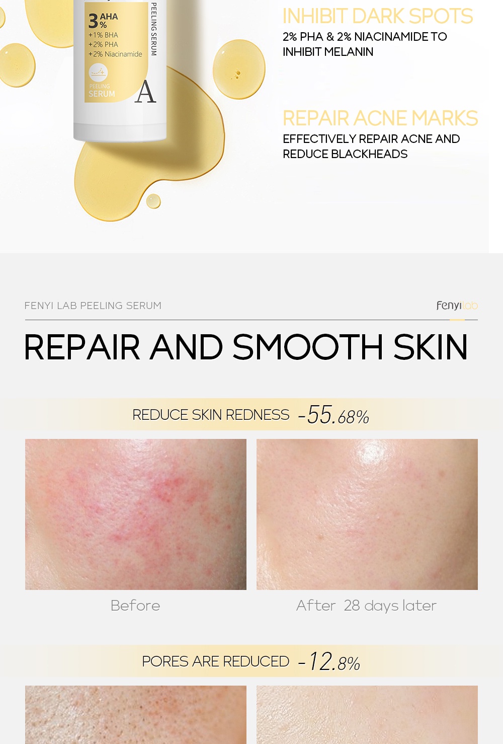 Fenyi Lab Peeling Serum 3% AHA Niacinamide Essence Shrink Pores Fade ...