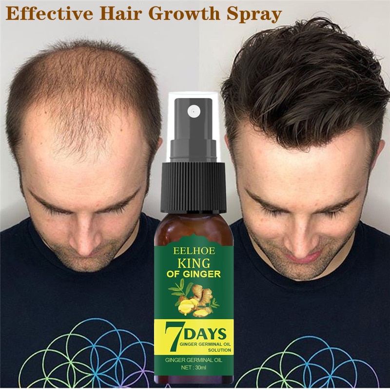 Eelhoe Hair Growth Essence Germinal Serum Essence Oil Natural Hair Loss