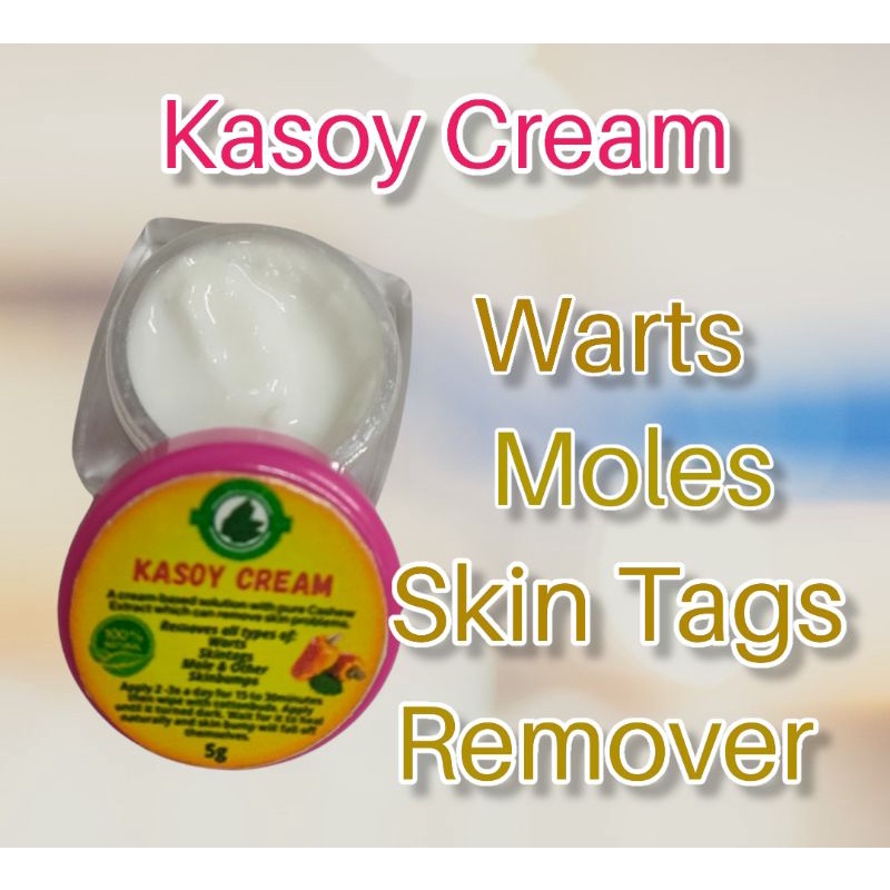 Pure Organic Kasoy Cream For Effective Removal of Warts,Moles,Skin Tags ...