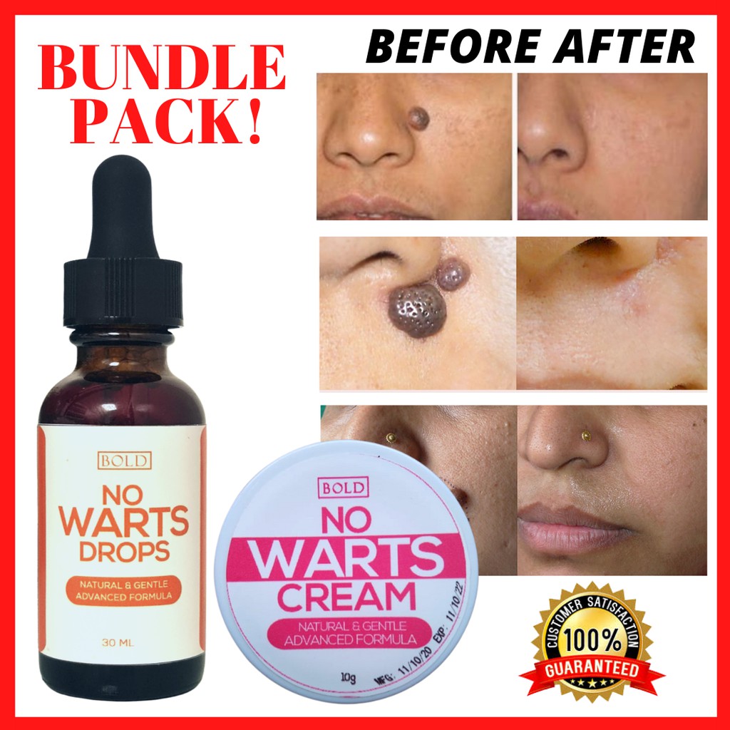 BUNDLE PACK!!! 1 No Warts Drops & 1 Cream!! THE 100% EFFECTIVE NO WARTS ...