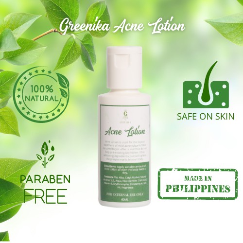[ ACNE REMOVAL LOTION ] Greenika Acne Lotion For Bacne Arms Back Body ...