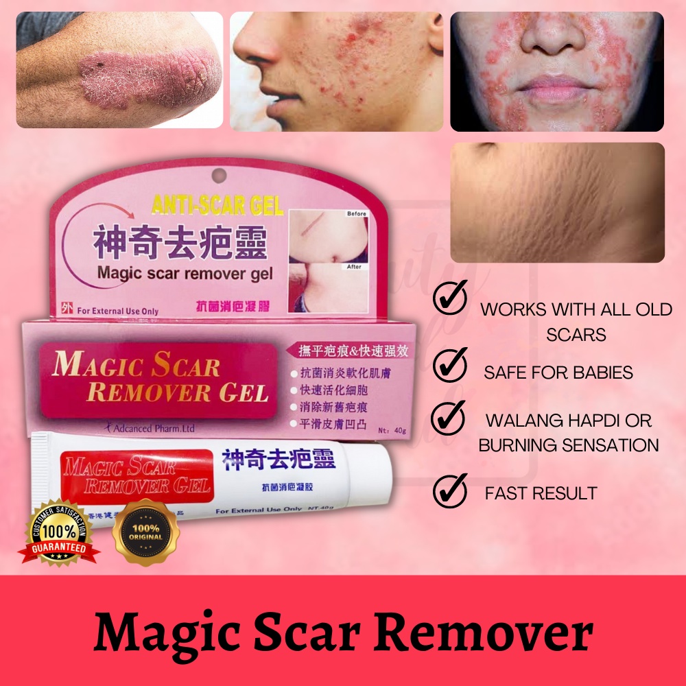 No1 Selling Original Magic Scar Remover Gel Best Buy for Acne Keloids ...