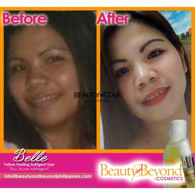 Astringent Before And After