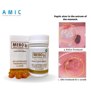 Acuherb Marketing Int'l Corp, Online Shop | Shopee Philippines