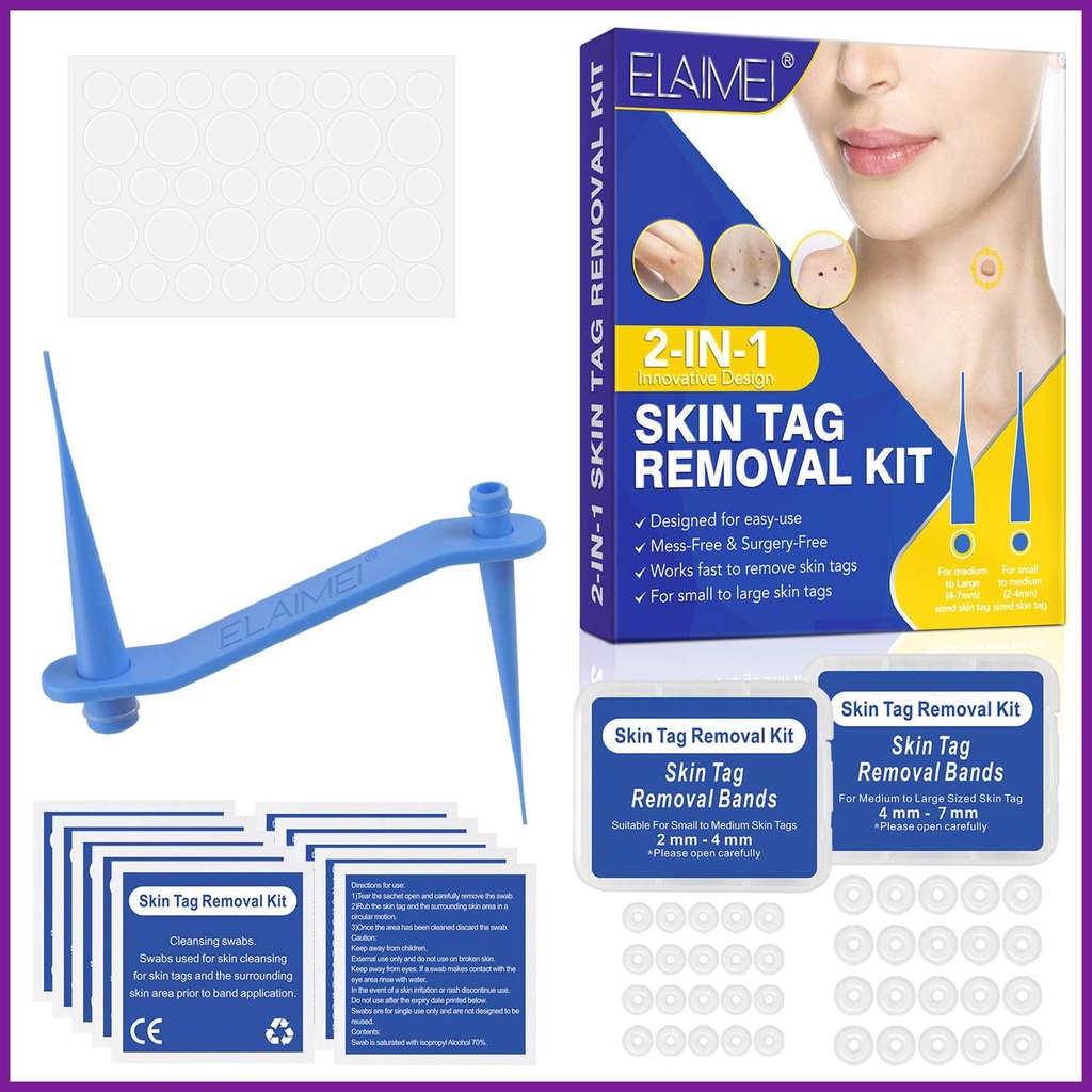 Skin Tags Removal Kit Dual Bands Auto Tags Fast Removal Kit Handy Skin ...