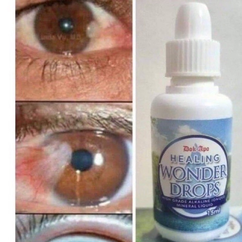 Eye Drops 15ml (Certified Original DokApo) | Shopee Philippines