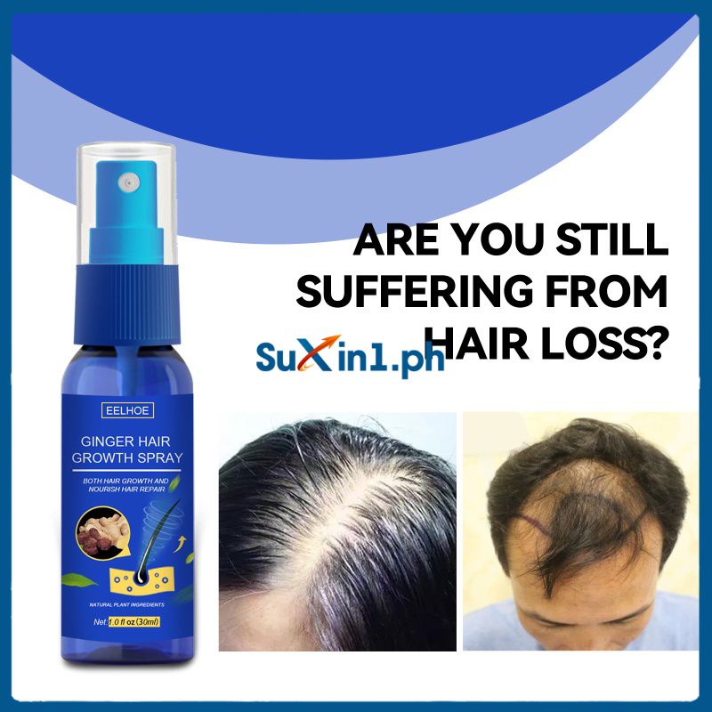 Eelhoe 30ml Hair Growth Spray Natural Anti Hair Loss Serum Baldness