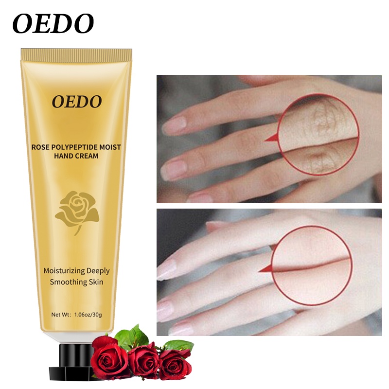 OEDO Rose Polypeptide Moist Hand Cream Repair Nourishing Hand Anti ...