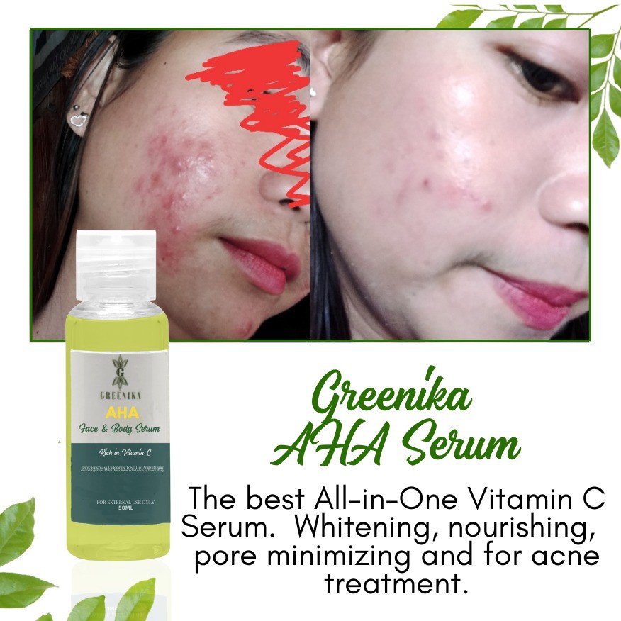 Greenikaph Online Shop Shopee Philippines