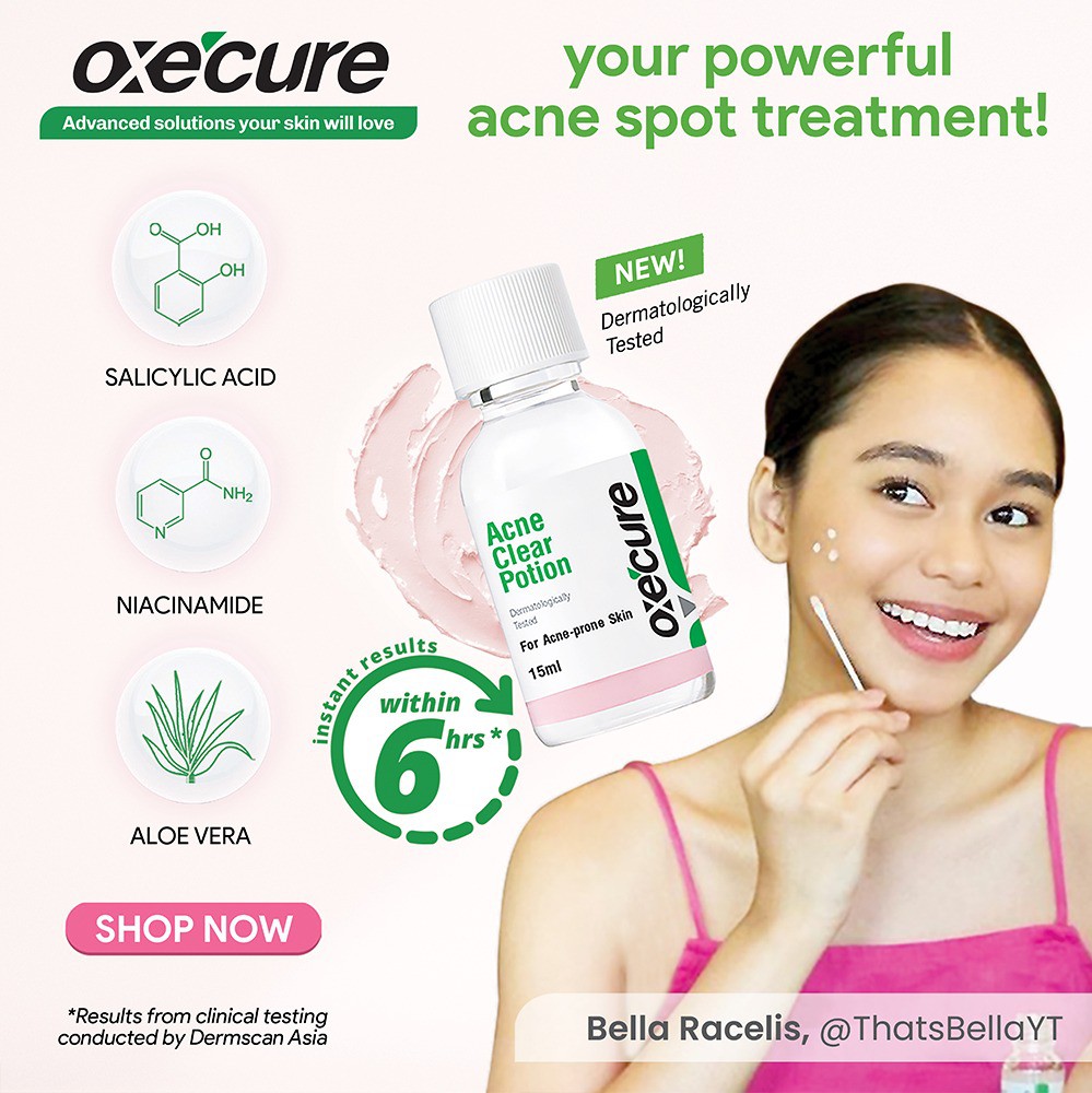 Oxecure , Online Shop | Shopee Philippines
