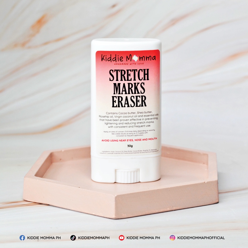 Kiddie Momma Stretch Marks Eraser | Shopee Philippines
