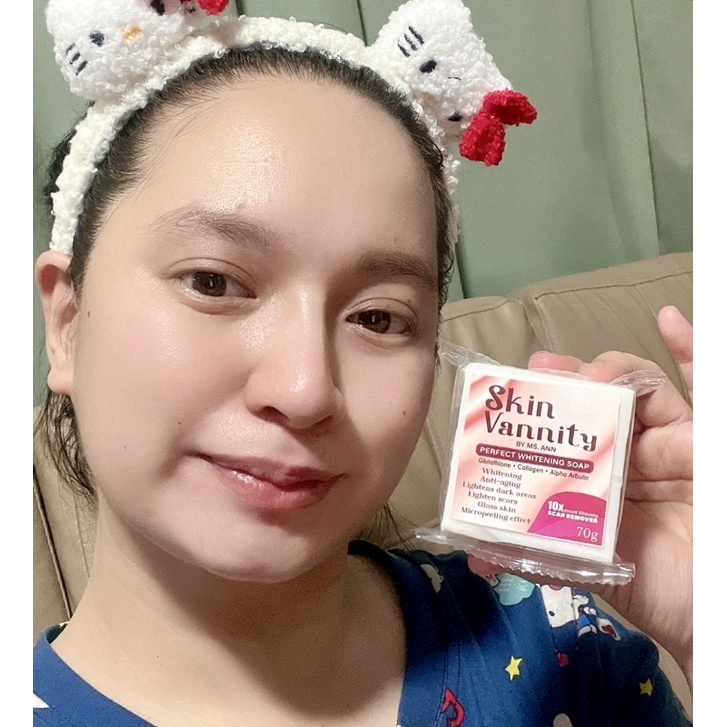 Skin Vannity Perfect whitening soap by Ms Ann | Shopee Philippines