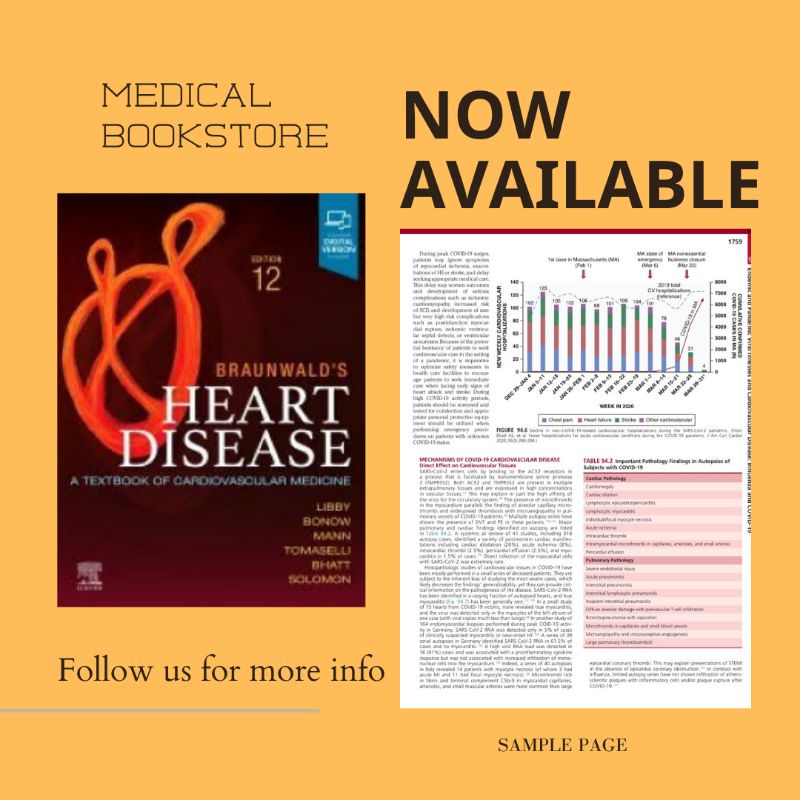 Braunwald’s Heart Disease 12th Edition | Shopee Philippines
