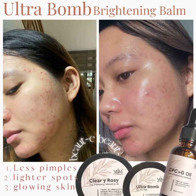 Underarm Makeup Philippines | Saubhaya Makeup