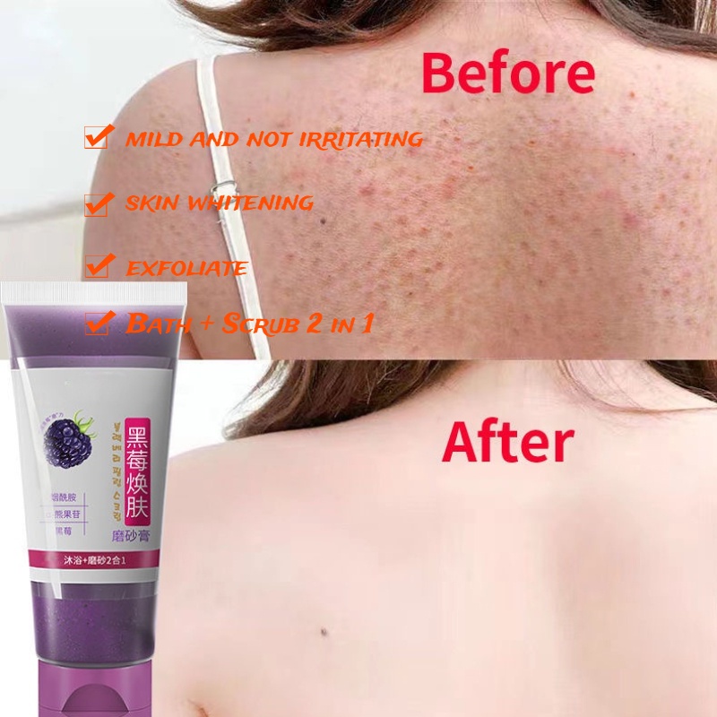 Blackberry Skin Exfoliating Deep Cleansing Chicken Skin Body Scrub ...
